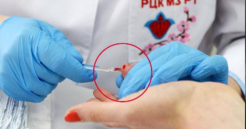 Почему кровь на анализ берут именно из безымянного пальца? — Лайм